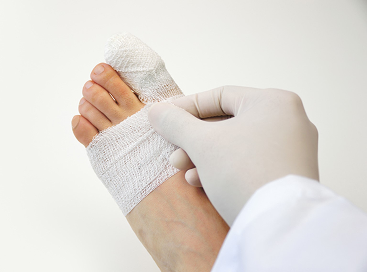 What Can You Do About A Broken Toe? - DeNiel Foot and Ankle Center ...