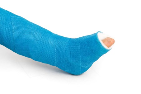 Driving with a Cast on Your Foot: What You Need to Know