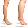 Managing Swollen Feet and Ankle Pain During Pregnancy