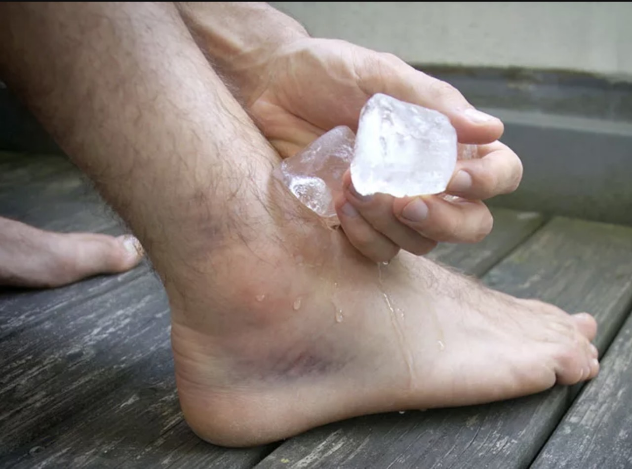 Unlocking the Benefits of the RICER Method in Sprain Recovery