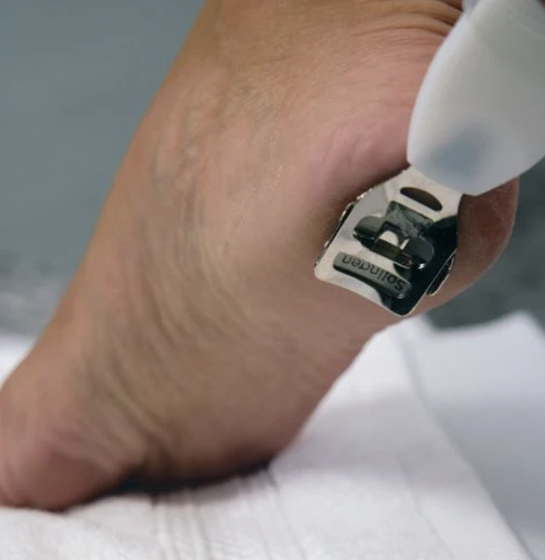 The Danger of Shaving Corns at Home